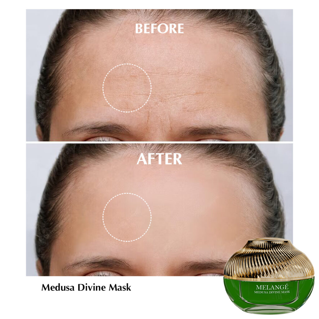 Medusa Divine Mask – MELANGÉ