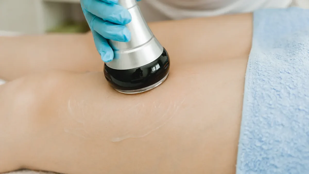 SLIMMING EMPIRE – RF body sculpting treatment – MELANGÉ